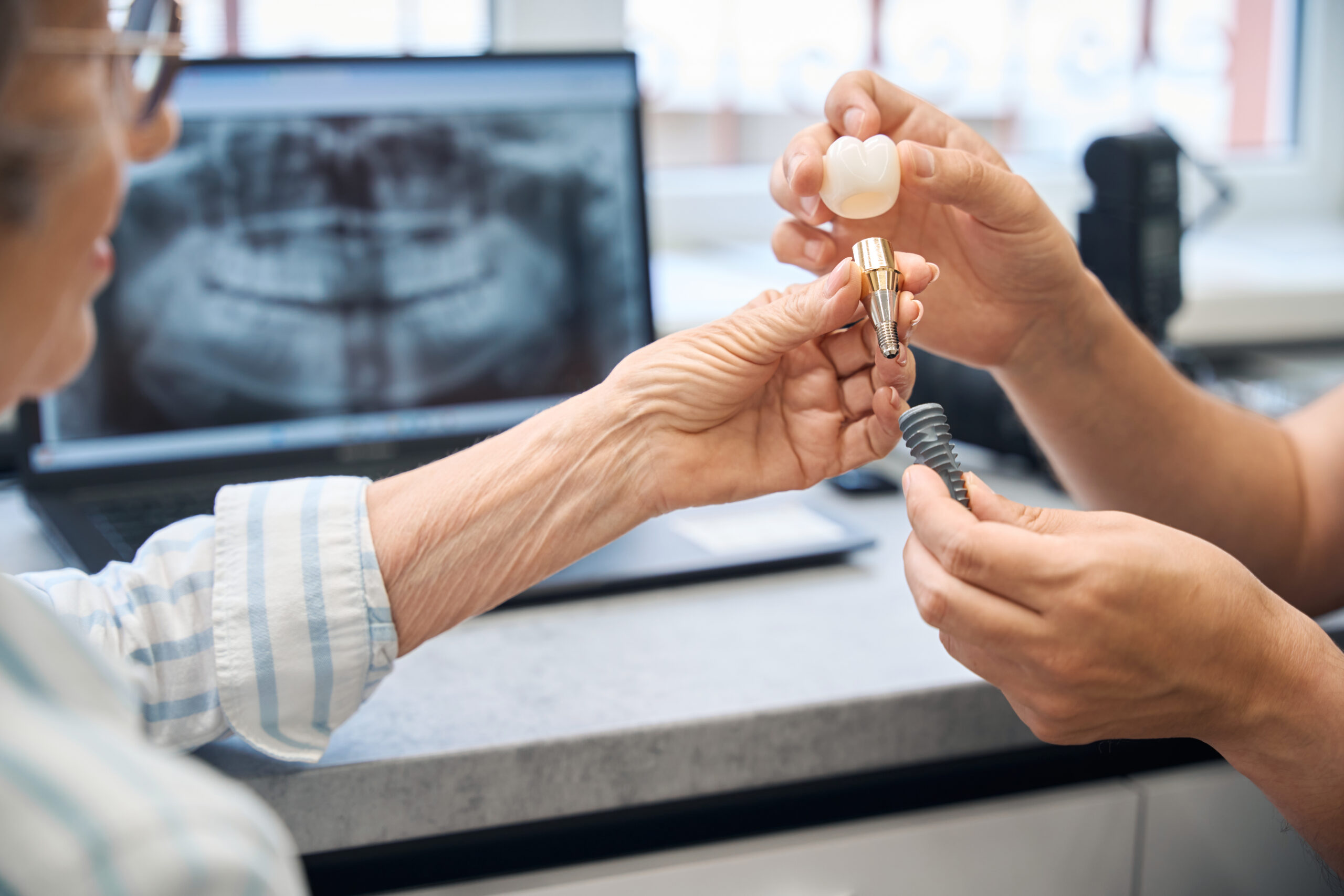 Dental Implants: Complete Guide | Kaizen Dental Center